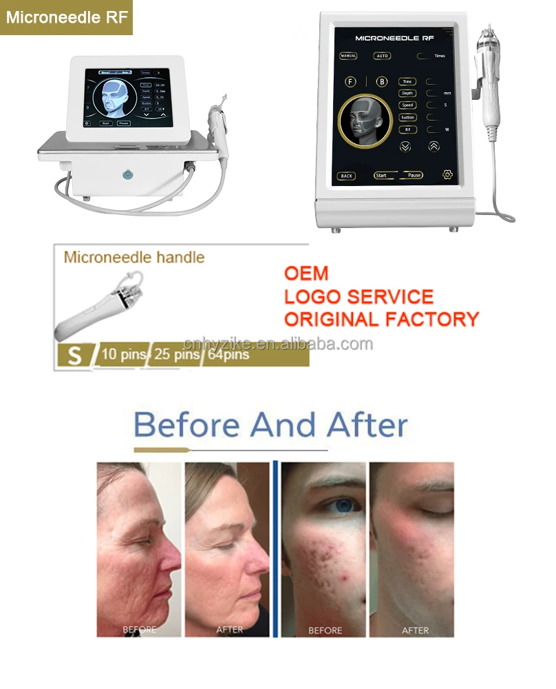 Rf Microneedling Machine Radiofrequency Scarlet Rf Skin Tightening ...