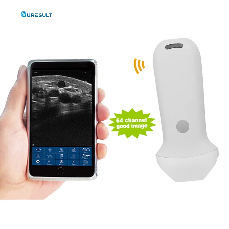 SURESULT L20 Portable Ultrasound Machine Connect with Laptop Mini ...