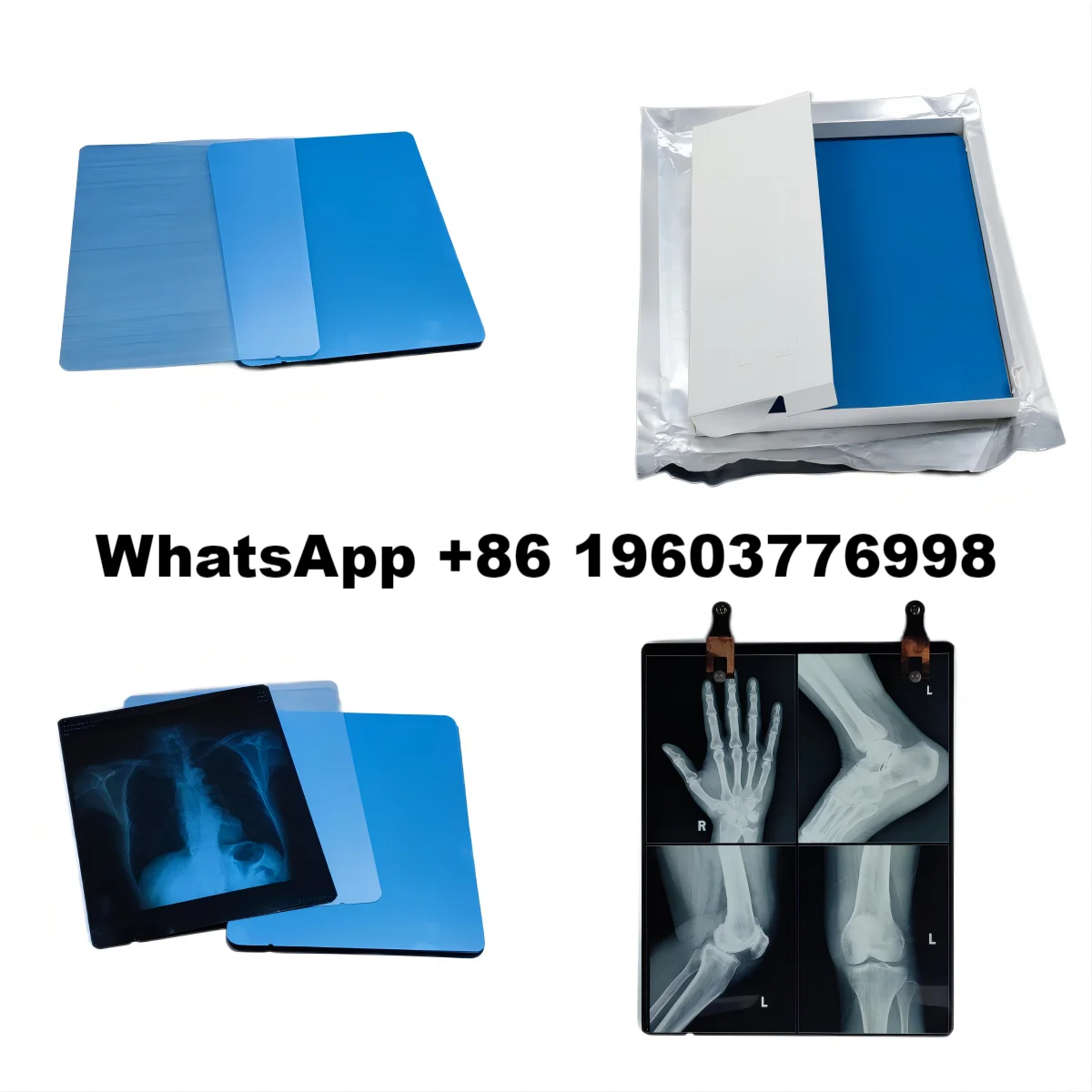 Medical Consumables - Xray Thermal Film for Digital Diagnosis