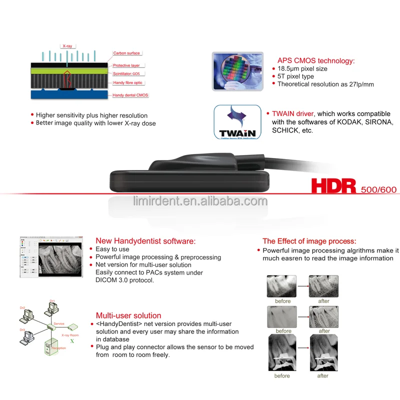 Handy Dental Sensor HDR600 Digital Intraoral Sensor Dental X Ray ...