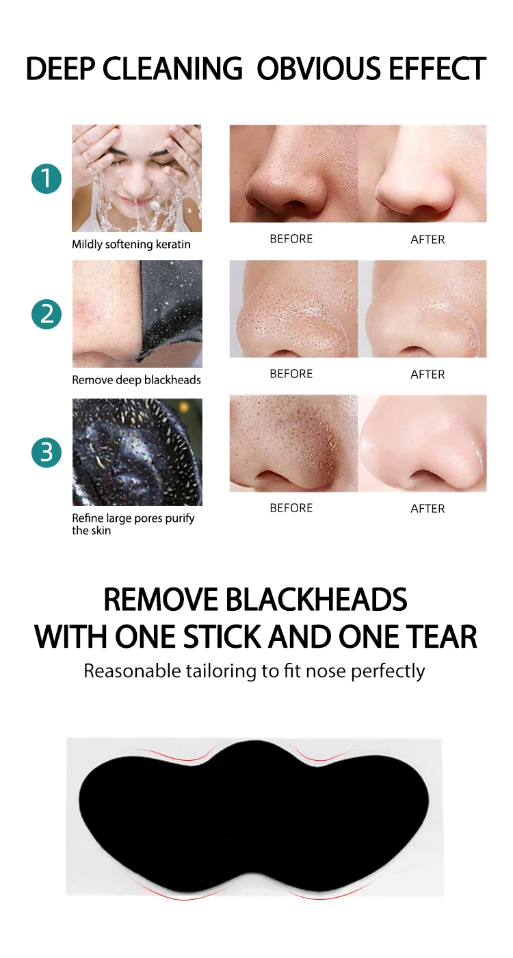 Hot Selling Wholesale Pore Tightening Nose Strips Remove Blackheads ...
