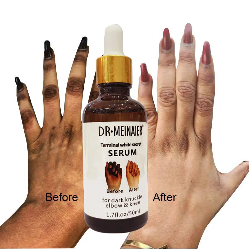 Dark Knuckles Fast Whitening Serum - Intense Stains Remover