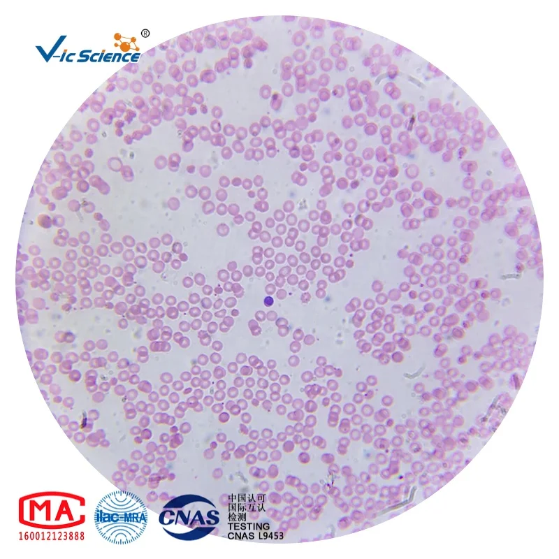Microscope Prepared Slides - Hematology Blood Smears