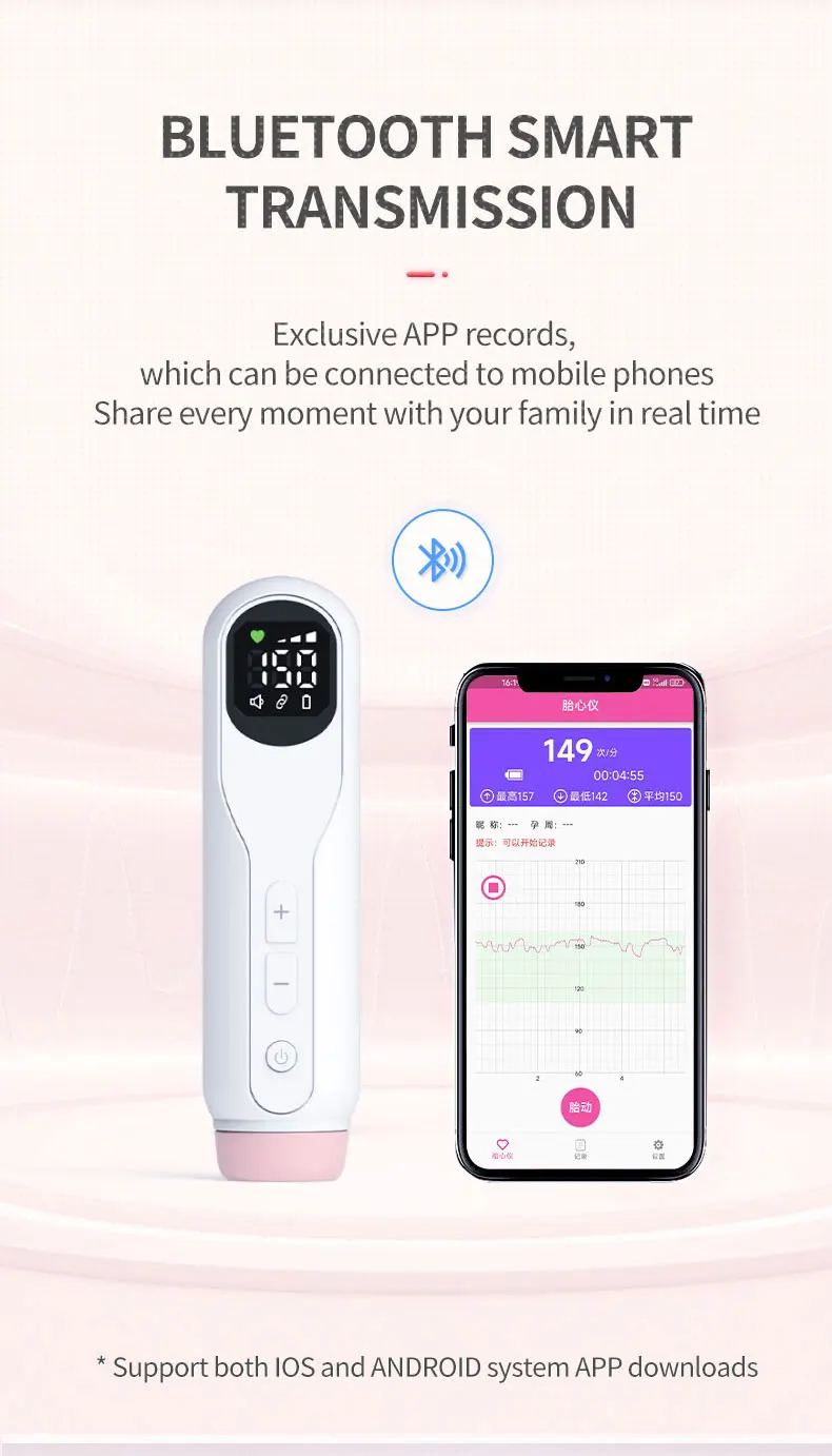 CONTEC10D Ultrasound Fetoscope - Digital Doppler Ultrasound