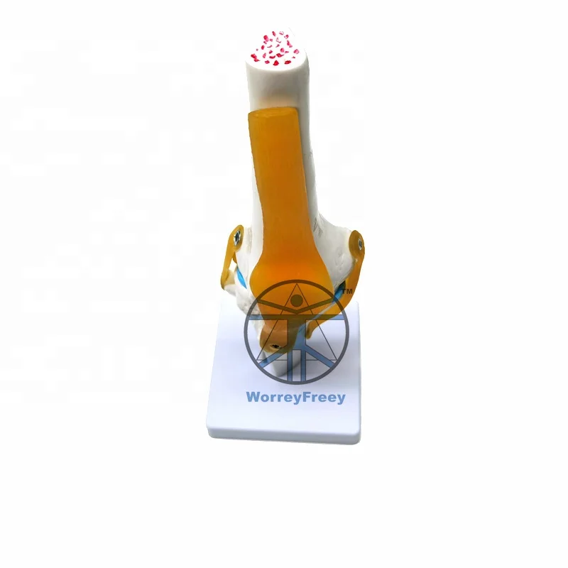 Medical Spine Endoscope Endoscopic Spine Surgery Teaching Model ...