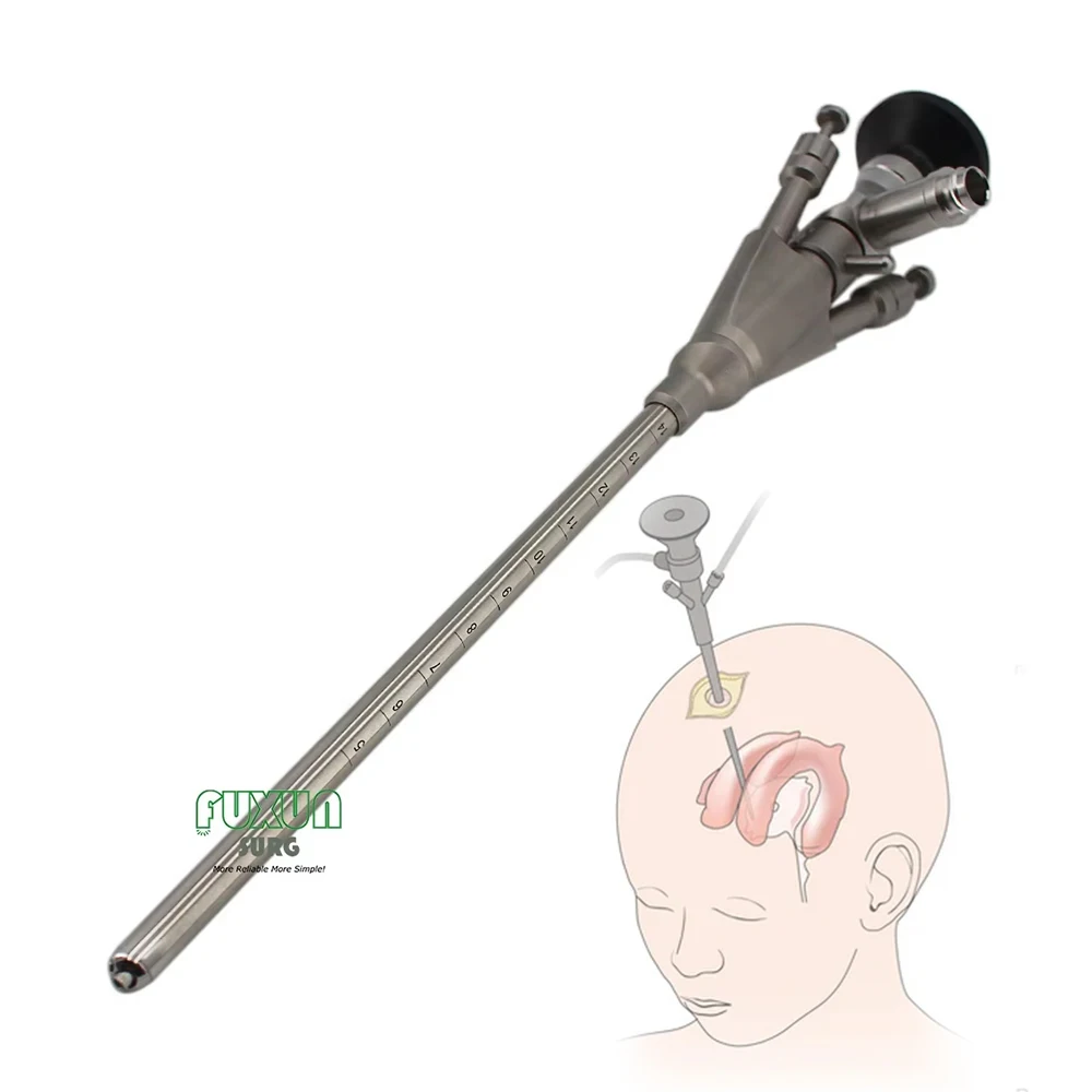 Medical Surgical Endoscopic Instruments Ventriculoscopy Ventriculoscope ...