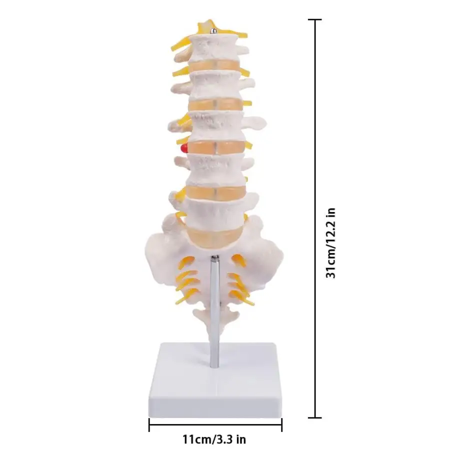 Medical Teaching Lumbar Vertebrae with Sacrum & Coccyx and Herniated ...