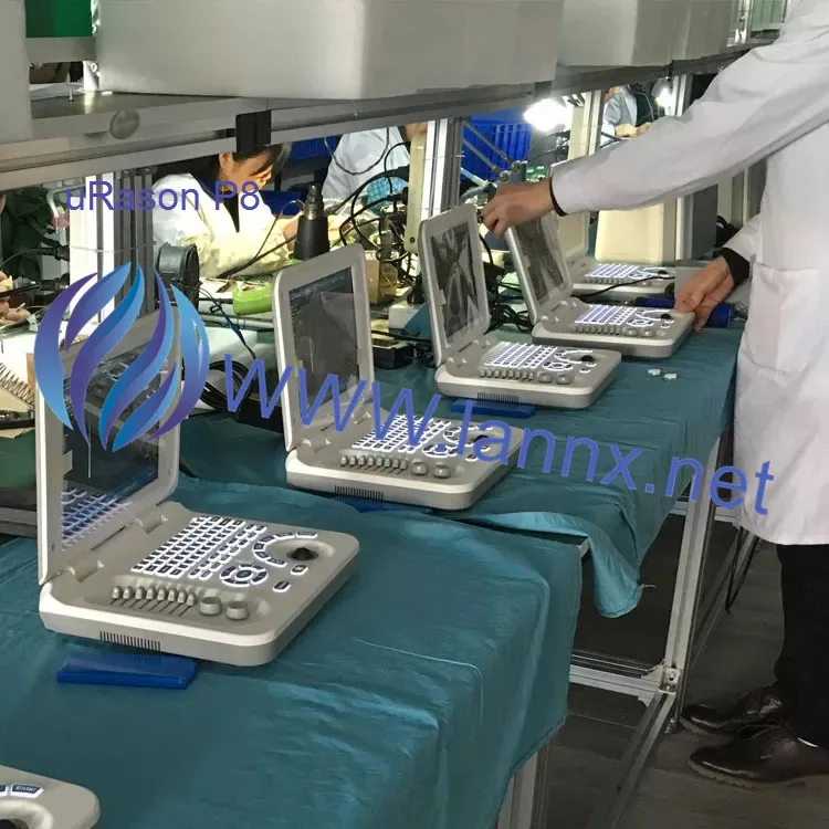 Lannx Urason N20 Medical Ultrasound Diagnostic System Cheapest Color Doppler Portable Ultrasound ...