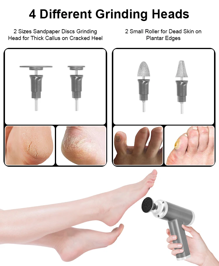 4500RPM Fast Speed Electric Foot Grinder Machine Removing Hard Dead ...