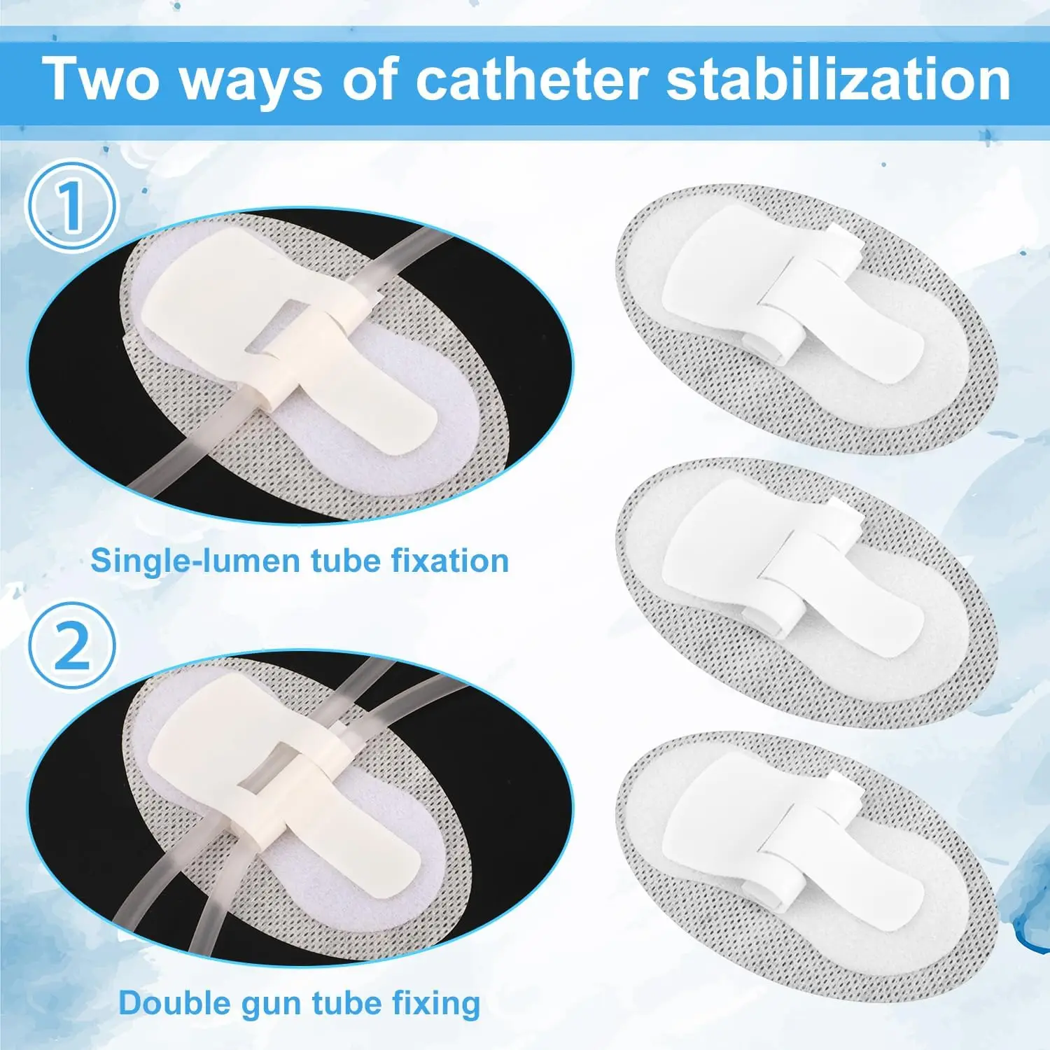 Secure Catheter Fixation Device - Adhesive Urethral Tape
