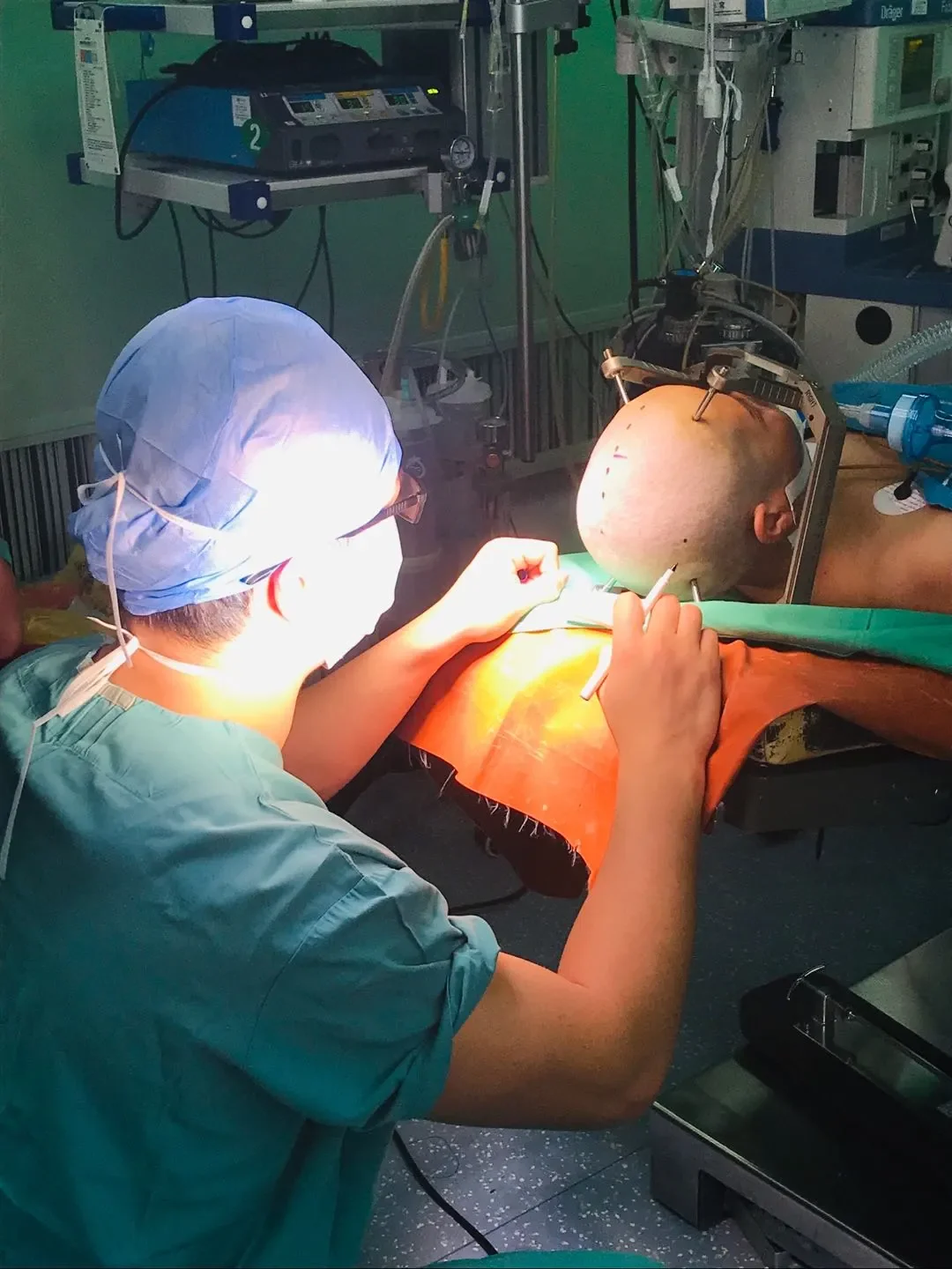 Brain Surgery Surgical Instruments Neurosurgery Brain Stereotaxic Head ...