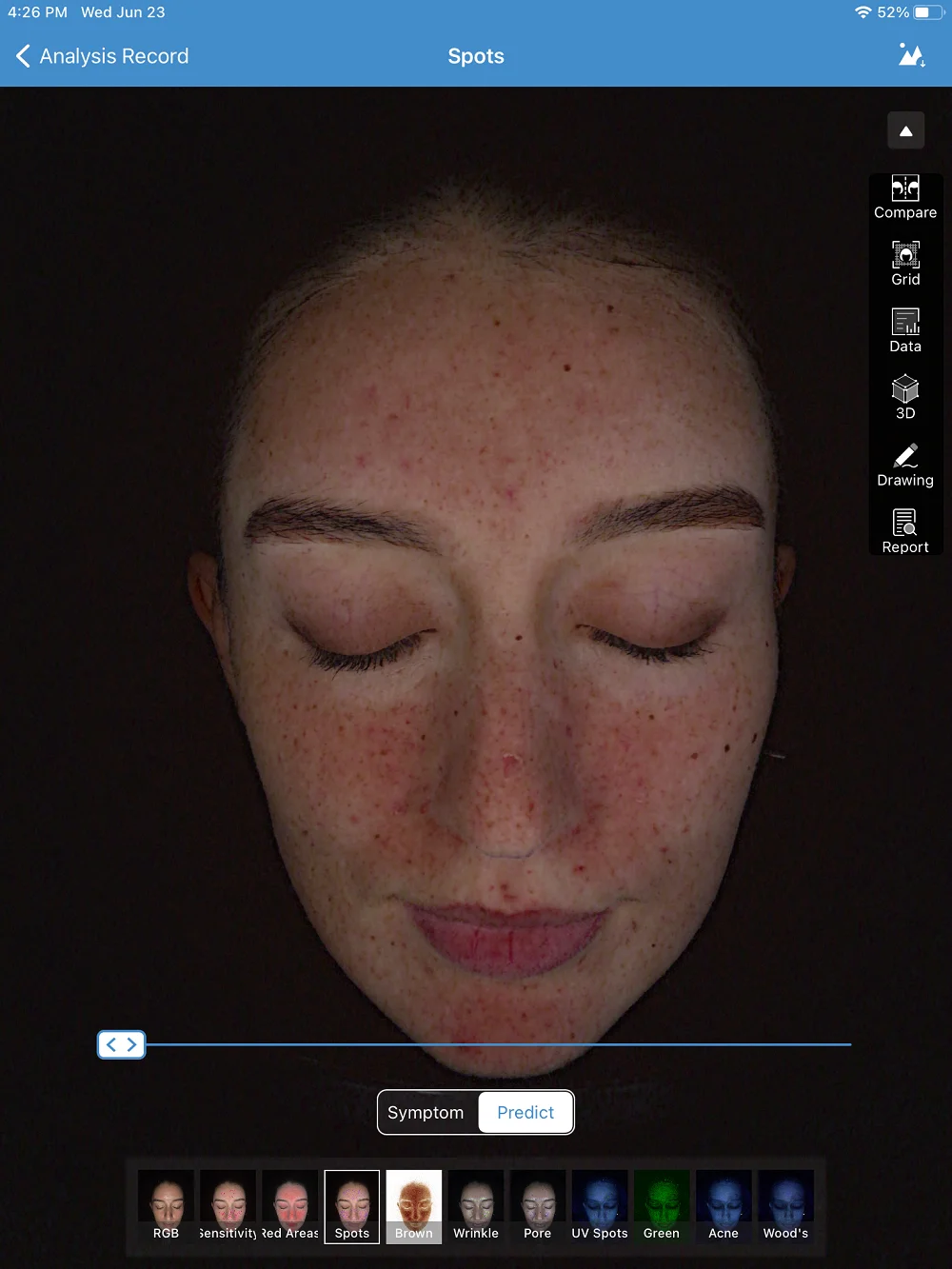 UV Light Facial Skin Scanner - Meicet MC10 Skin Analyzer