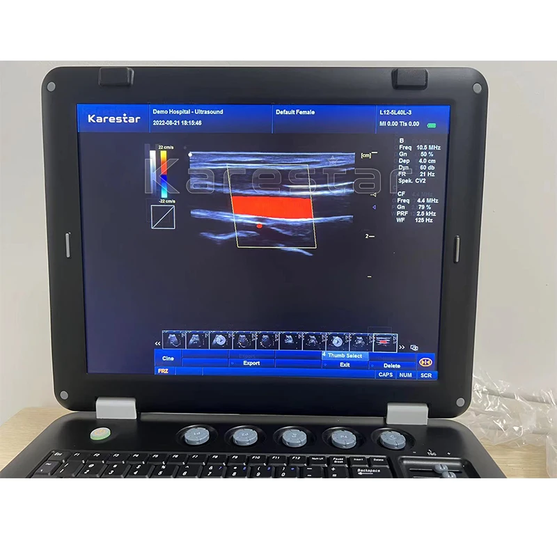 Portable Medical 3d 4d Echocardiography Ultrasound Machine Color ...