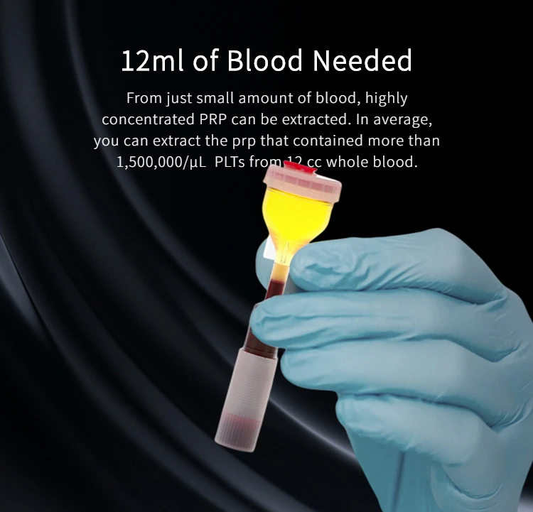 Y PRP Tube, PRP Plasma Separation ,suitable for Orthopedics and Medical ...