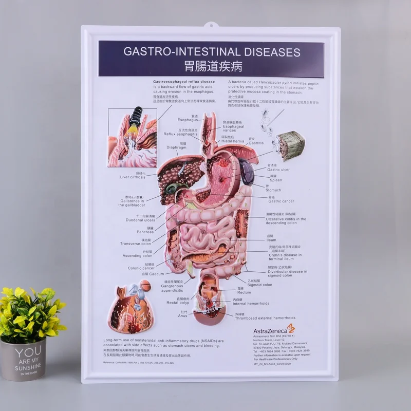 3D Embossed Medical Wall Chart, 3D Poster Made of PVC, Measures 50 X ...
