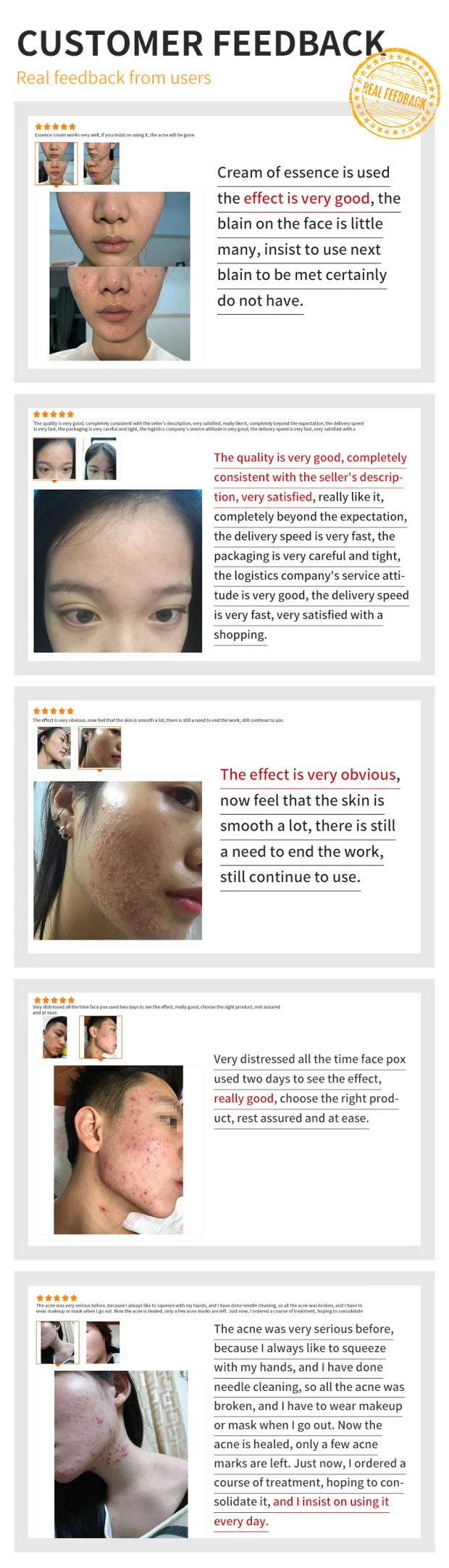 Colloidal Sulfur Acne Cream - Effektive Pimplen Behandlung