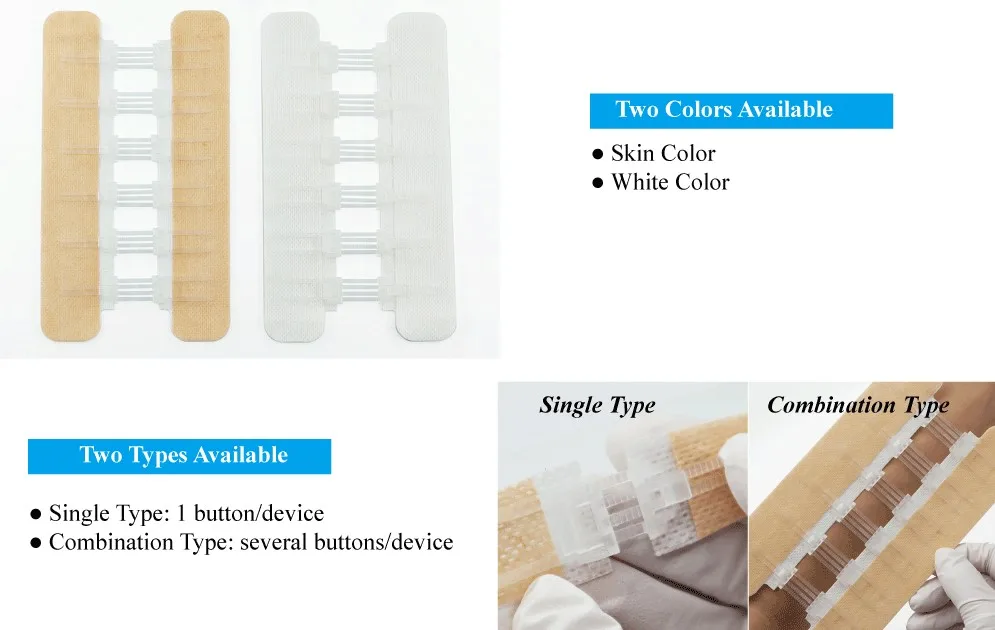 Trummed Medical Zipper - Wound Closure Without Stitches