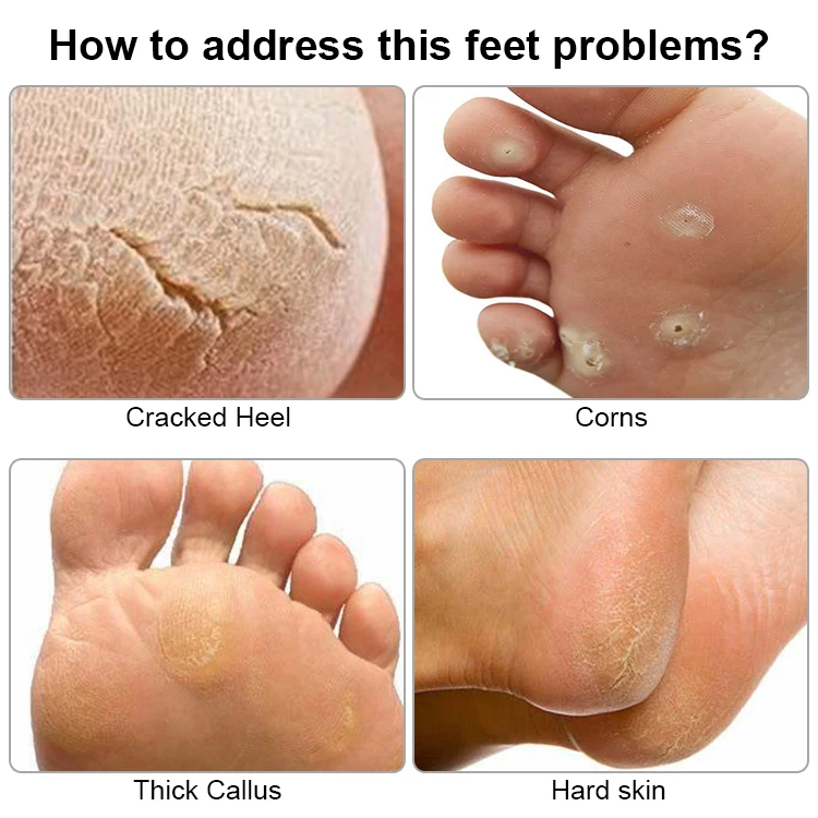 4500RPM Fast Speed Electric Foot Grinder Machine Removing Hard Dead ...