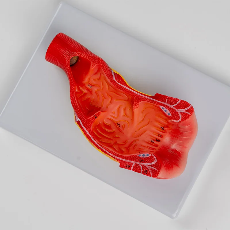 Human Anatomical Digestive System Model Intestinal Anatomy Biology ...