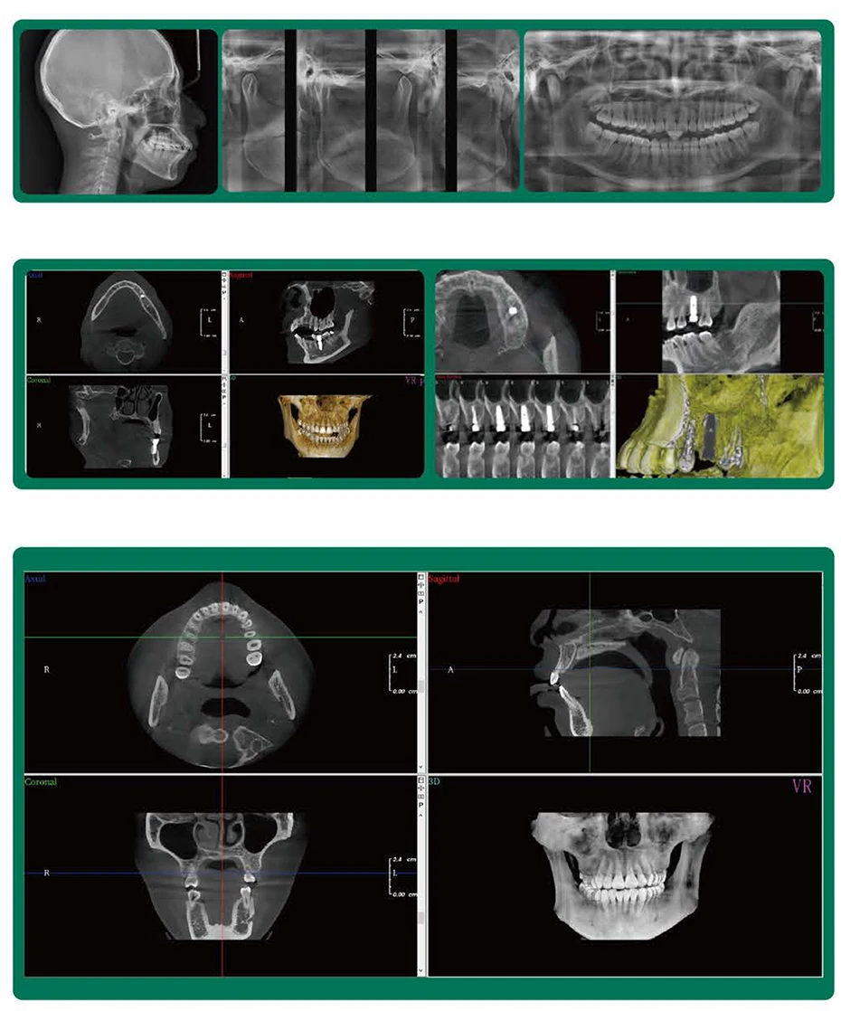 Dental Instruments - MSLDX20 Digital CBCT 3D OPG X Ray Scanner