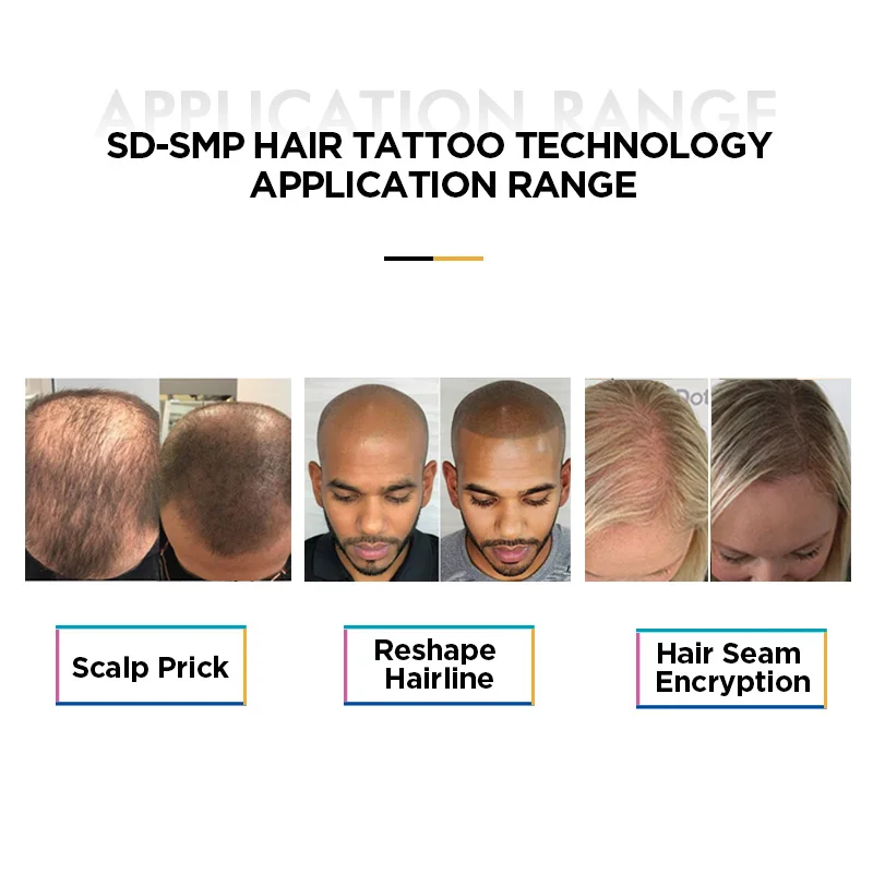 Alibaba.com: SMP Tattoo Scalp Micropigmentation Kit, Permanent Makeup ...