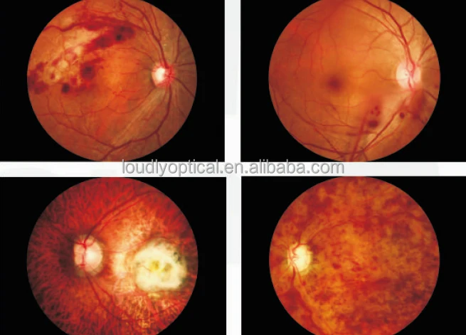 Hot Selling Sk-650a Digital Retinal Camera Price Popular Model Sk-650a ...