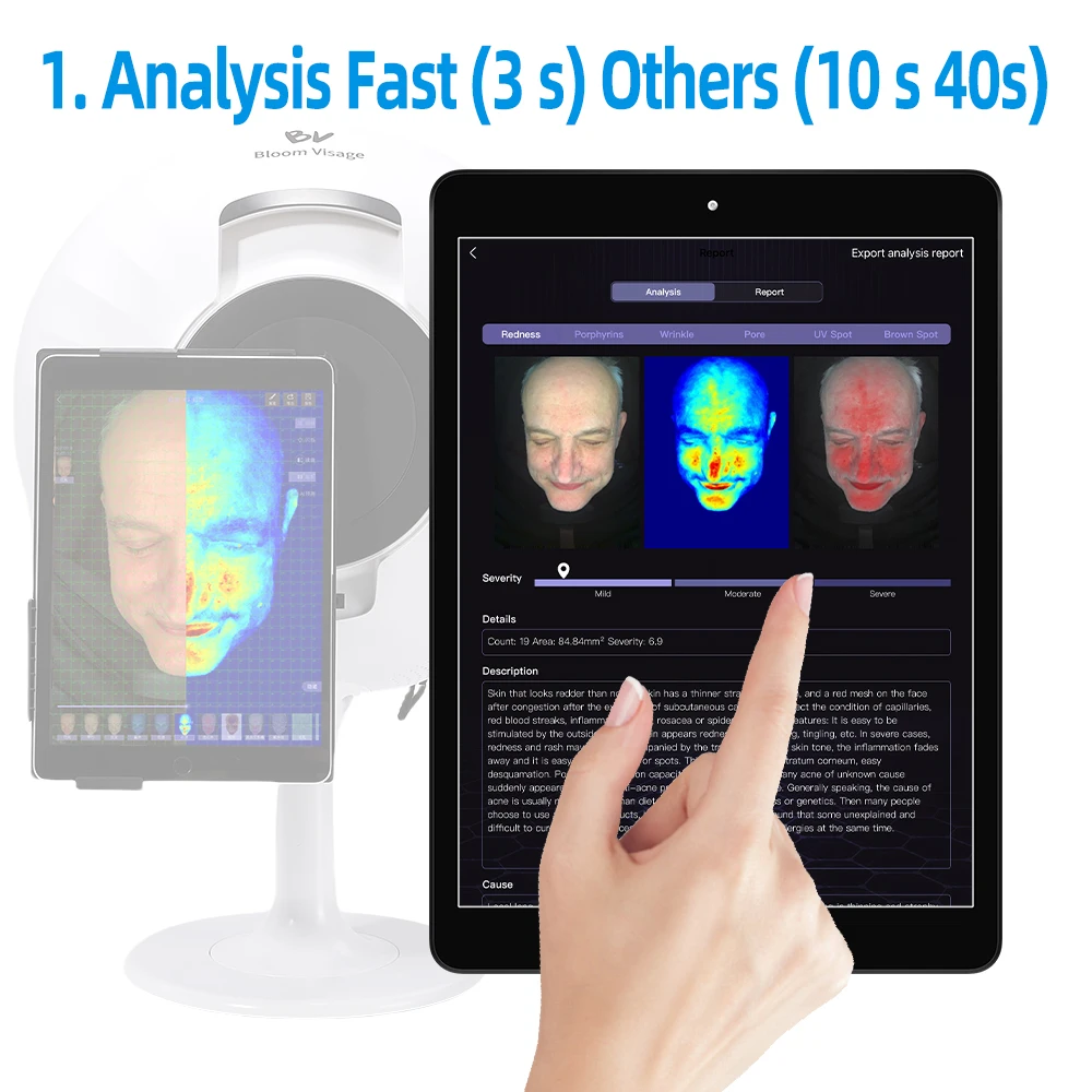 2025 the Hot Professional Skin Potential Problem Detection and Analysis ...