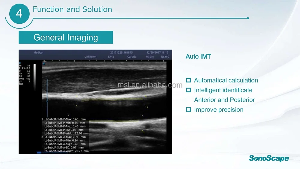 Sonoscape E2 3D 4D Ultrasound - Advanced OB/GYN Diagnostics