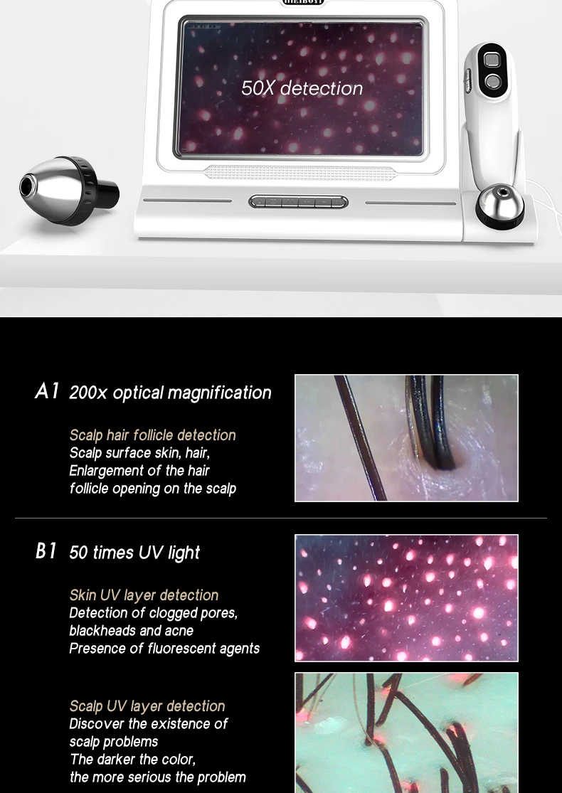 MEIBOYI HD Hair Follicles Scanner - Scalp & Skin Analyzer