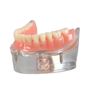 Implant All On 4 Model With Screw Driver Transparent Base With ...