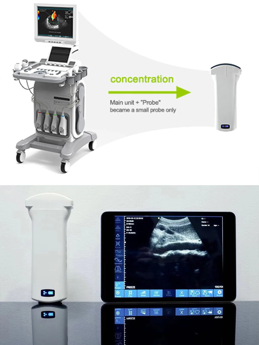 Compact Mobile Ultrasound With Convex Probe Featuring Ultrasound-on ...