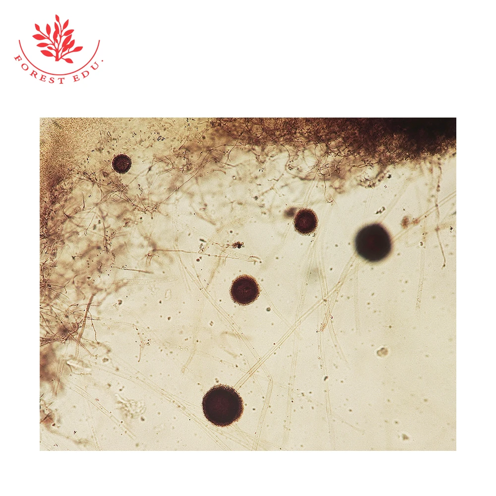 Forest Microscopic Microbiological Specimen Sectioning Aspergillus ...