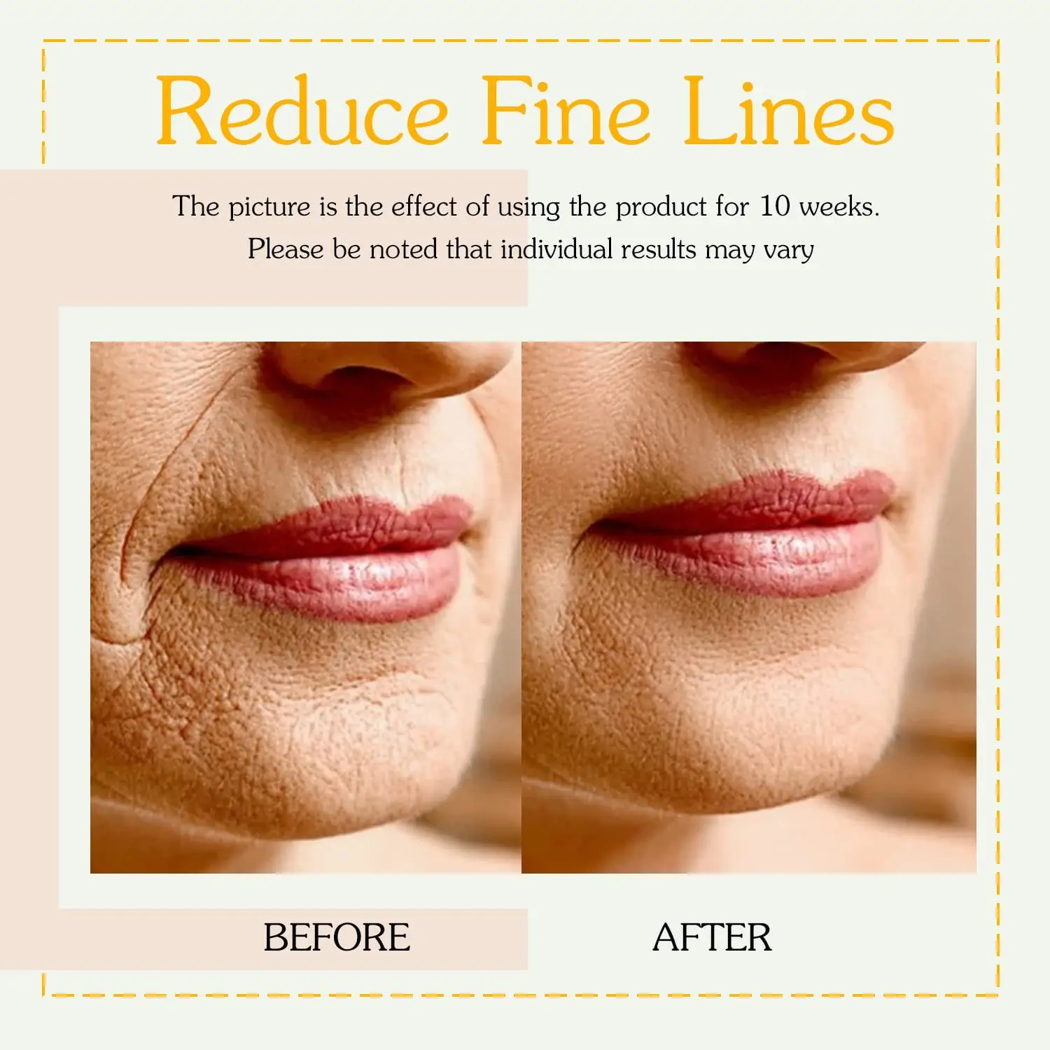 Niacinamide/adenosine To Rejuvenate/whiten/moisturize And Anti-aging ...