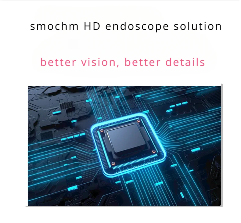 smochm Thoracoscopy 5M Pixels Endoscope HD camera module visua ...