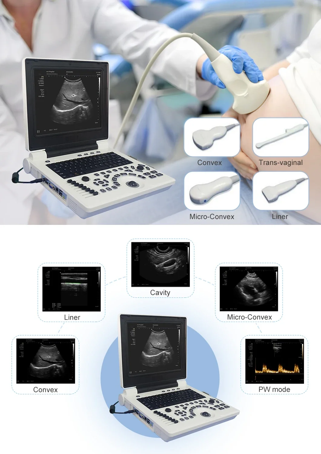 Ultrasound Systems Clinic Linear Convex Array Probe B/W Ultrasound ...