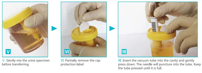 Medical Use Specimen Container 120ml - Urine Collection Cup