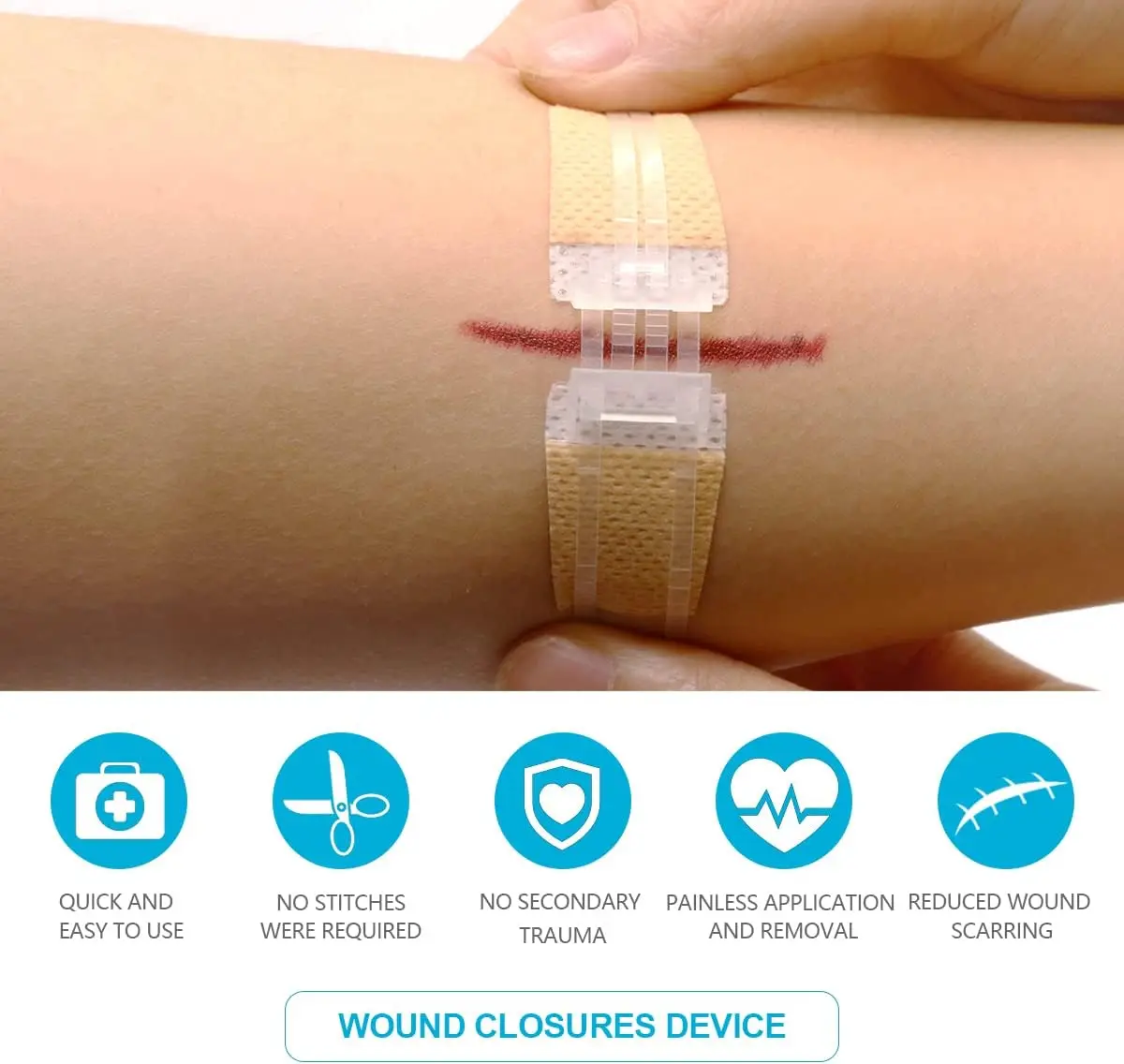 Zip Sutures Wound Closure Device(Non-Woven Fabric) Wound Care Butterfly ...