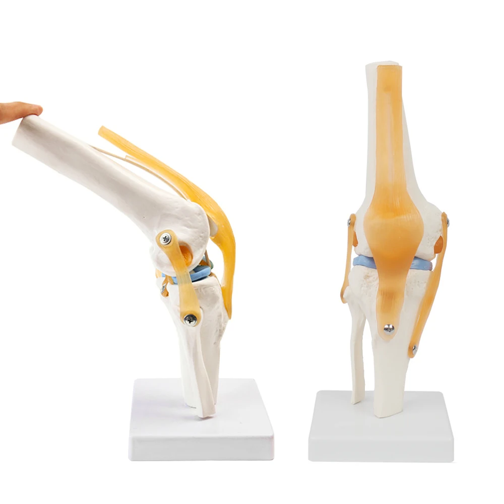 Artificial Knee Joint Model Meniscus Injury Diagnosis Prosthetic Knee ...