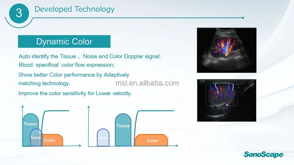 Sonoscape E2 3D 4D Ultrasound - Advanced OB/GYN Diagnostics