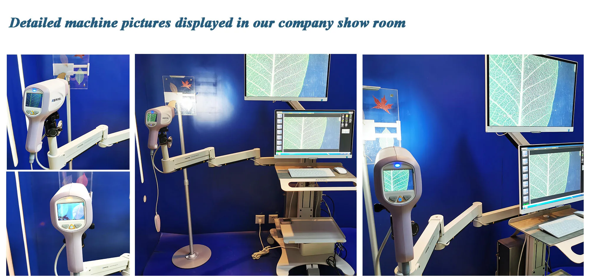 Gynecological Colposcope Video Digital HD Camera for Cervical Cancer Exam