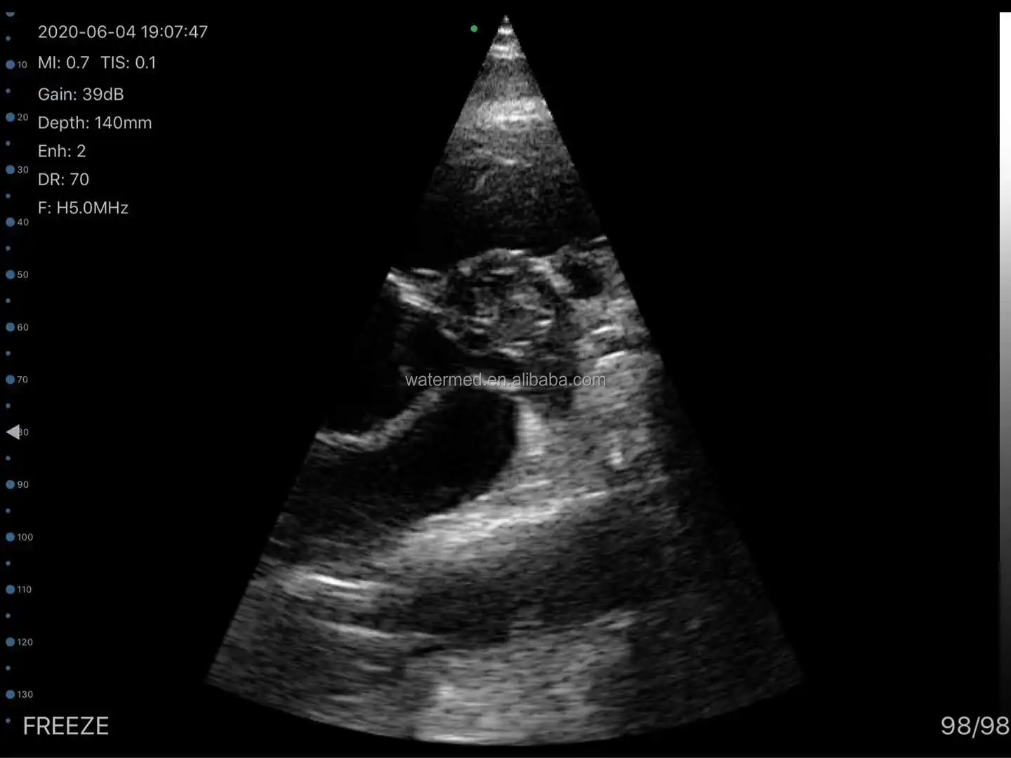 Linear/Convex/Phased Array 3 in 1 Handheld USB Ultrasound Double Probes ...