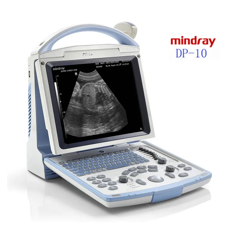 Mindray DP-10 Ultrasound - Advanced Diagnostic Imaging