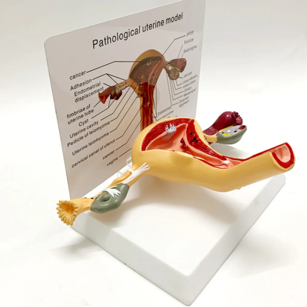 Custom High Quality PVC Plastic Anatomy Human Female Life-size Transparent Uterus Model Uterus ...