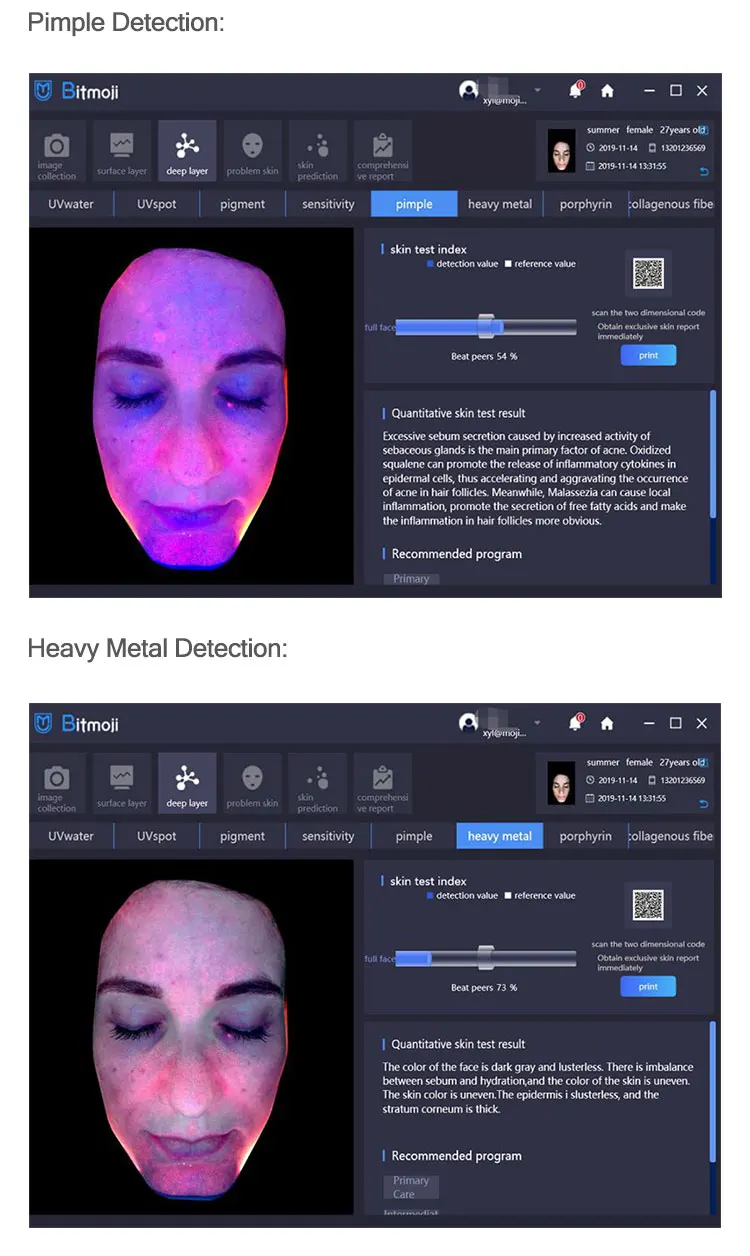 2020 Ce Approved Portable 3d Digital Smart Skin Test Skin Camera ...