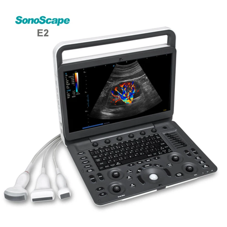 Sonoscape E2 Ultrasound Machine - Portable and Versatile