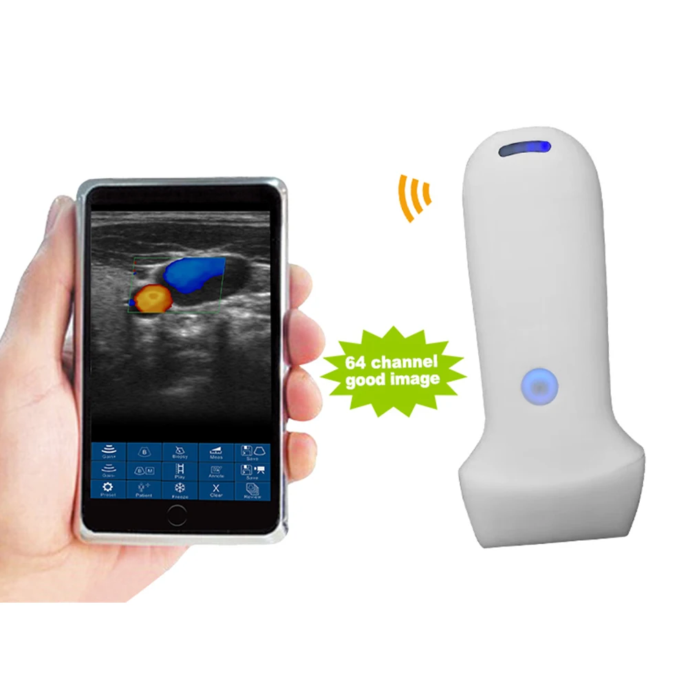 Suresult 5g Wireless Handheld Color Doppler Ultrasound Equipment For ...