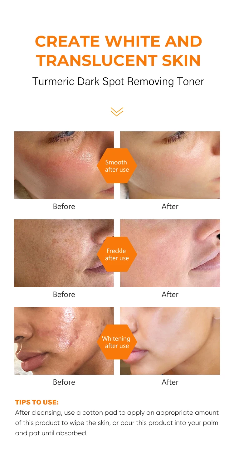 Turmeric Toner - Fade Dark Spots & Blemishes Effectively
