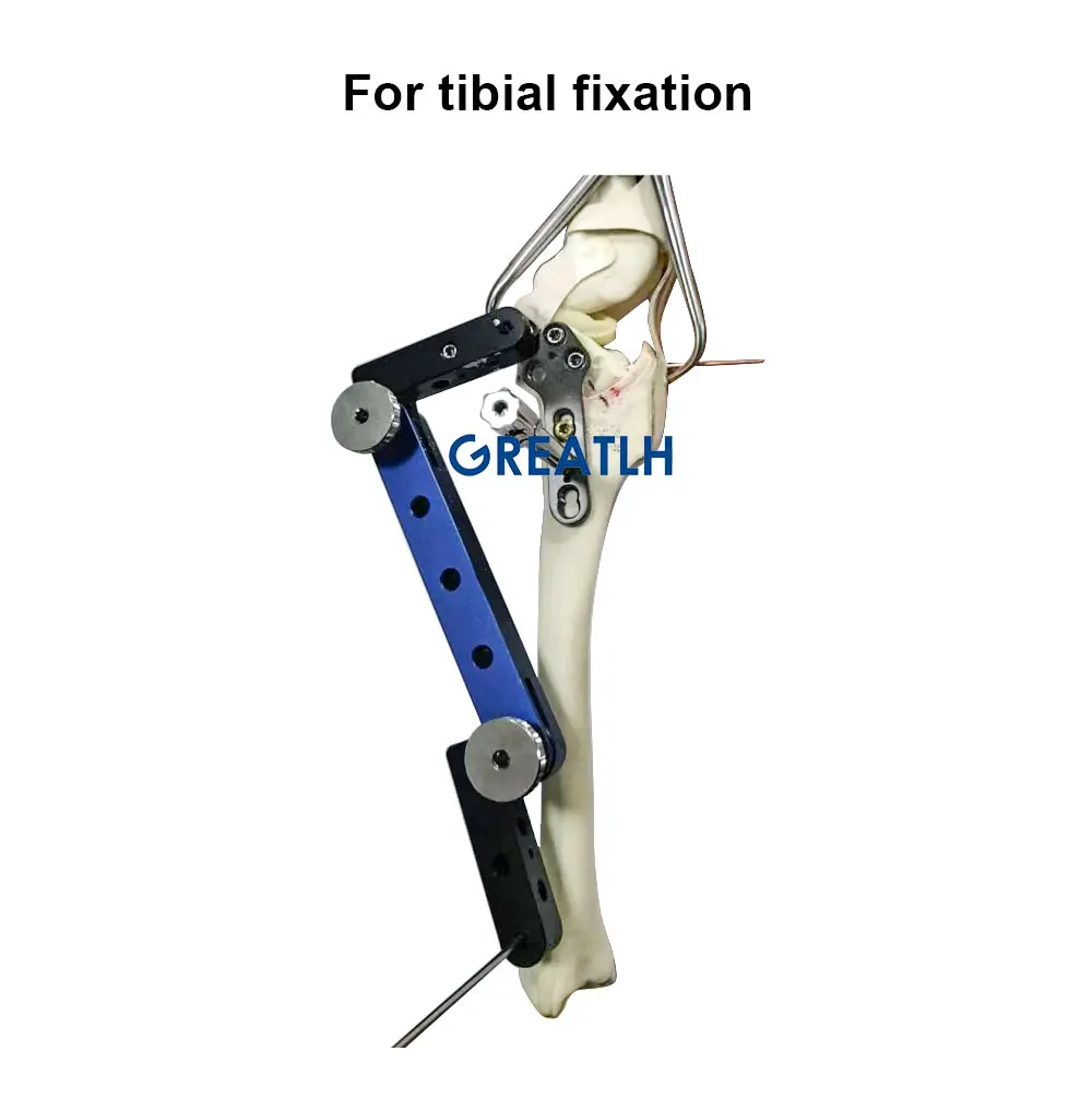 High Quality Medical Orthopedic Tibial Plateau Leveling Osteotomy ...