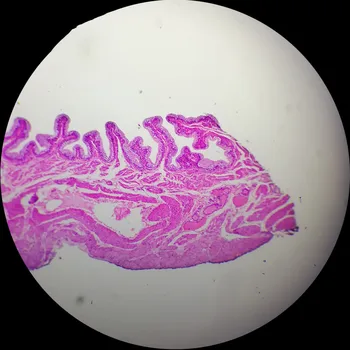 Glass Material And Other Subject 100pcs Human Histology Slides Set Cell ...