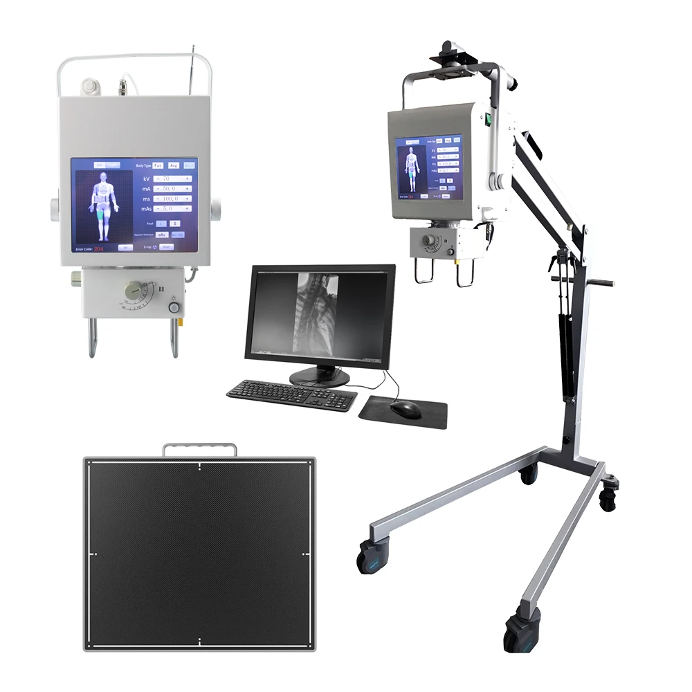 Portable X Ray Machine Stand For Mobile Digital X-Ray Machine MSLPX15 ...